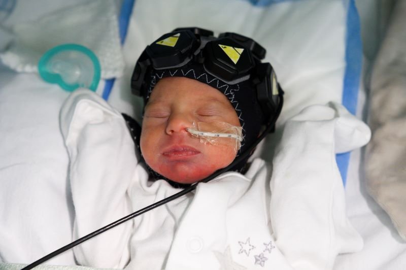 Cutting-edge baby brain scan technology is world first | CUH